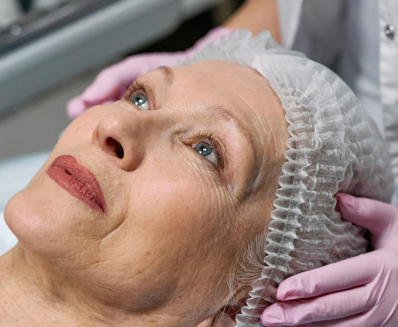 Effective Endolift Skin Tightening Therapy Los Angeles CA | Ecologica ...